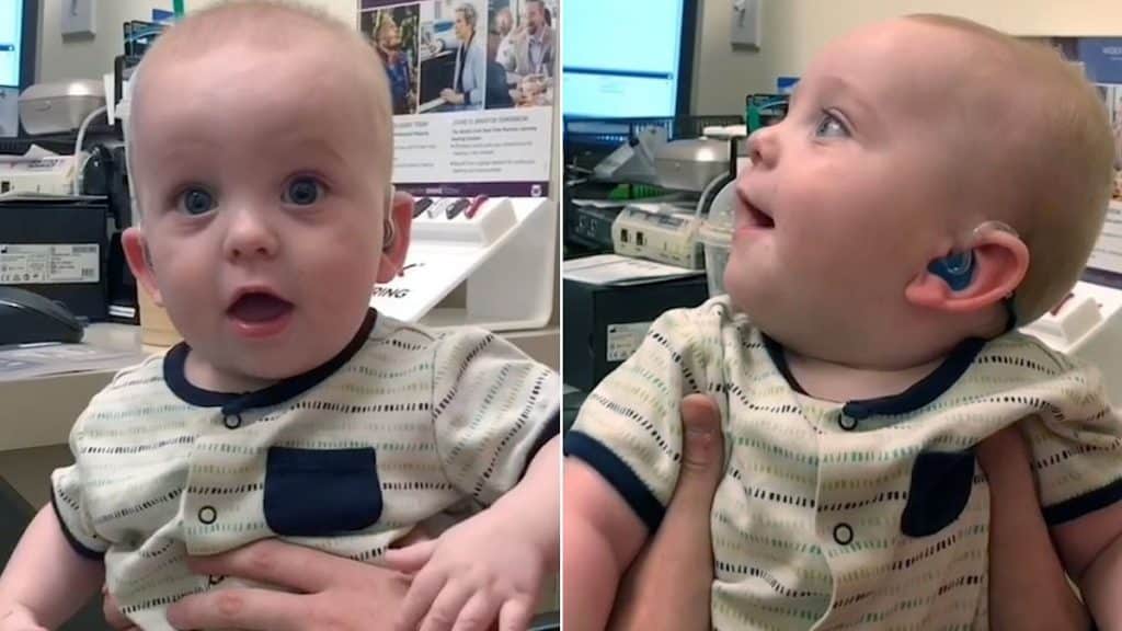 Baby Hears Mom And Dad For First Time As Hearing Aids Activated